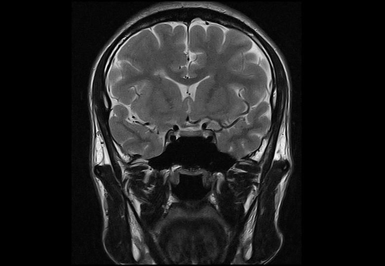 Sistema de MRI con Superconductor
