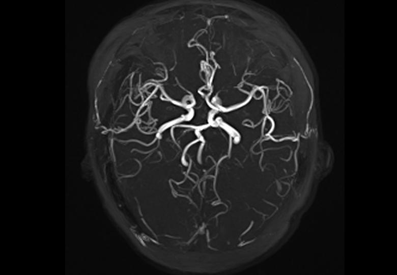 Sistema de MRI con Superconductor