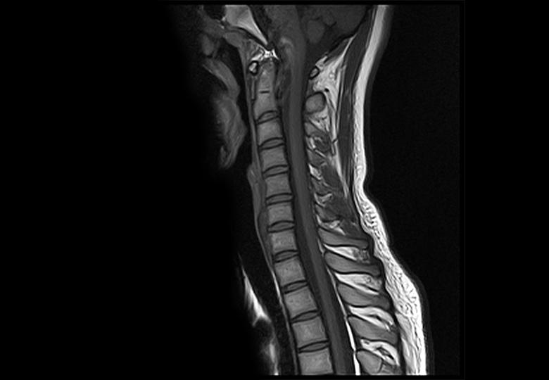 Sistema de MRI con Superconductor