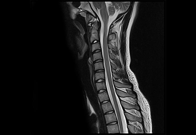 Sistema de MRI con Superconductor