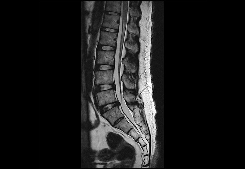 Sistema de MRI con Superconductor