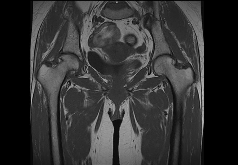 Sistema de MRI con Superconductor