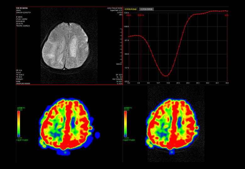 Superconducting MRI System