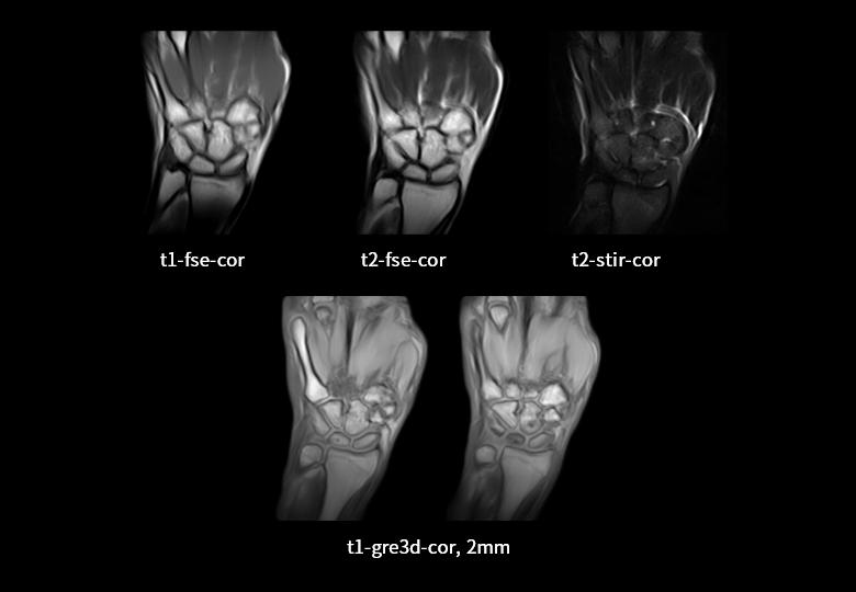 Permanent MRI System