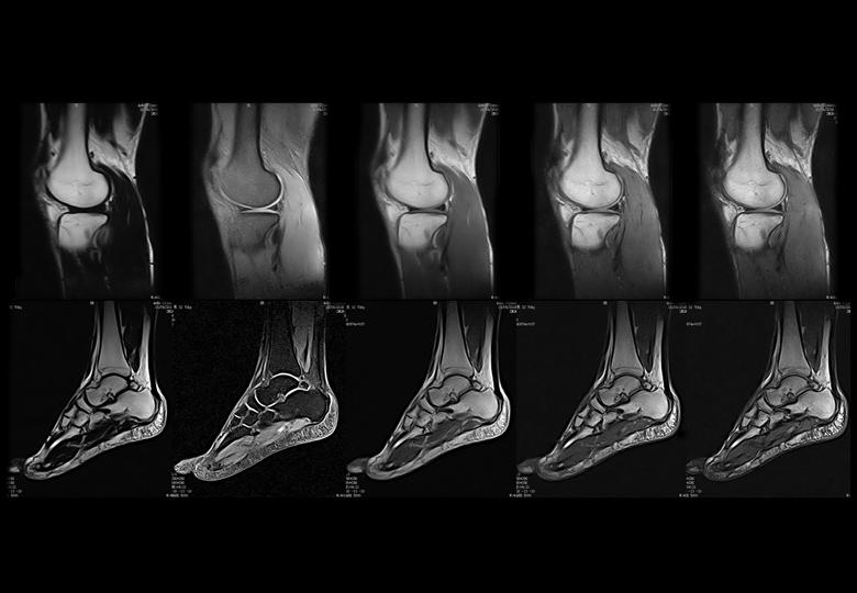 Permanent MRI System