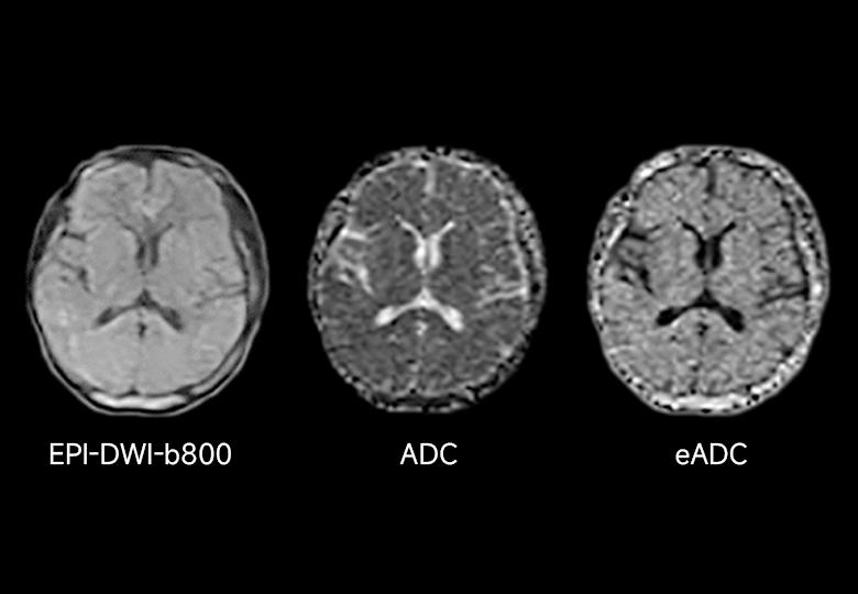 Permanent MRI System