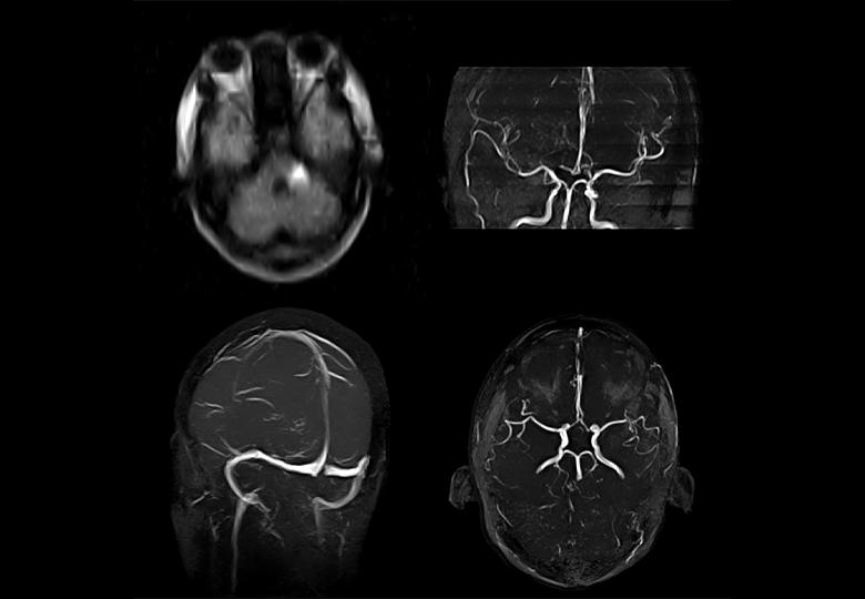 Permanent MRI System