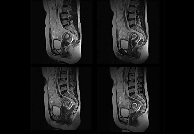 Permanent MRI System