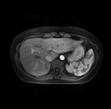 Superconducting MRI System