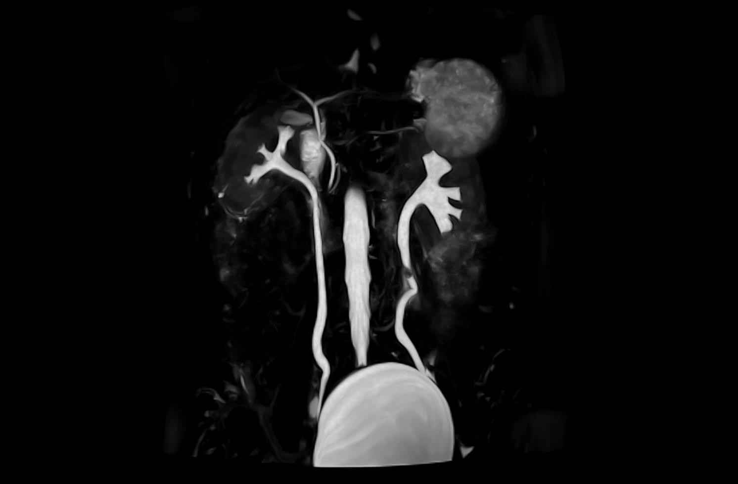 Superconducting MRI System