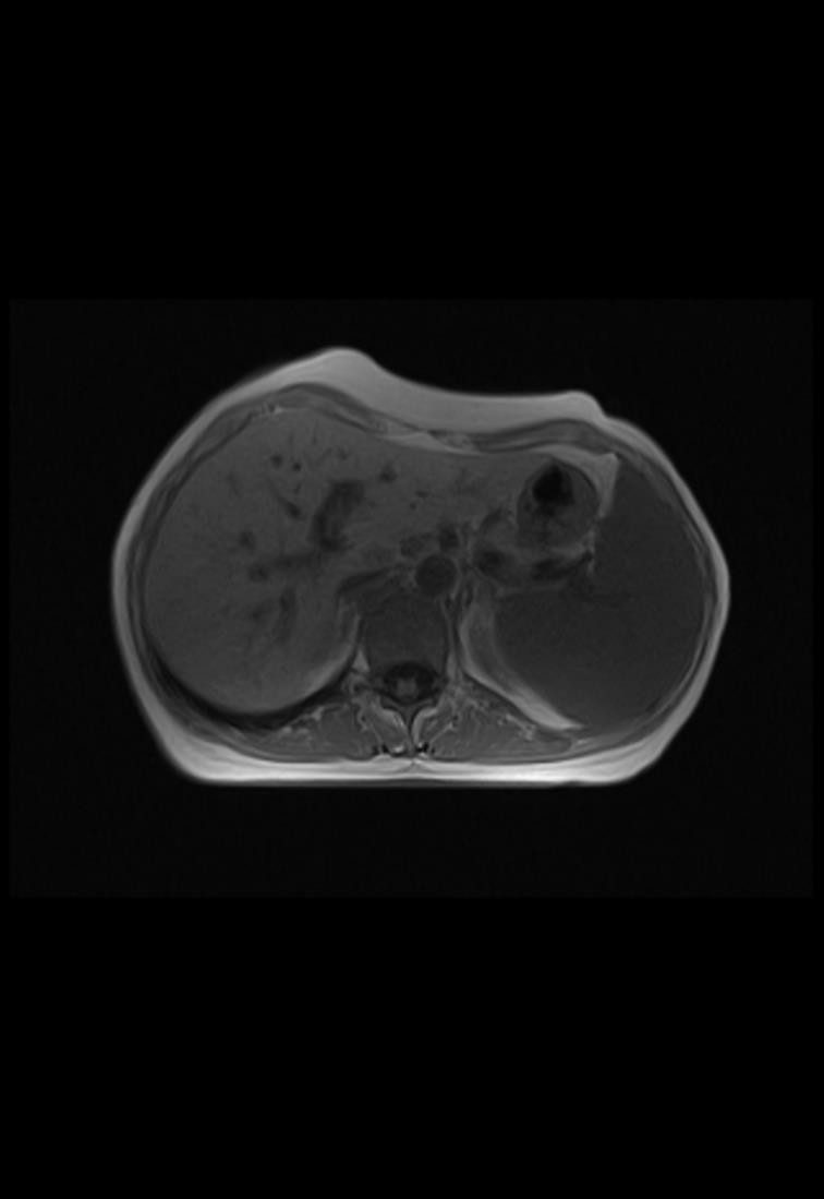 Superconducting MRI System