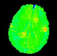 Superconducting MRI System