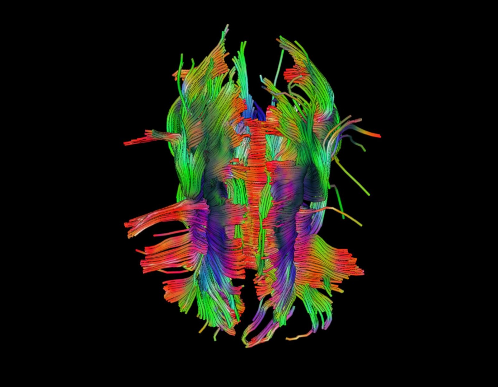 Superconducting MRI System