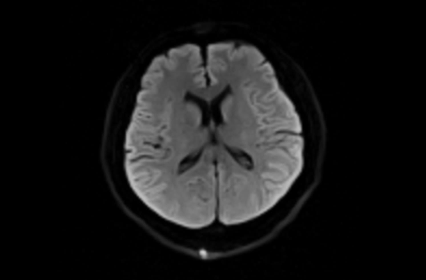 Superconducting MRI System