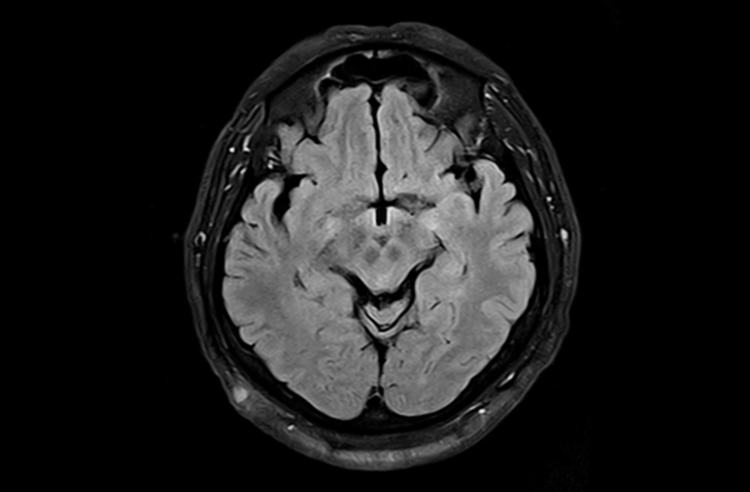 Superconducting MRI System
