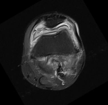 Superconducting MRI System