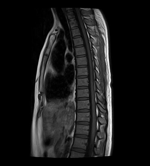 Superconducting MRI System