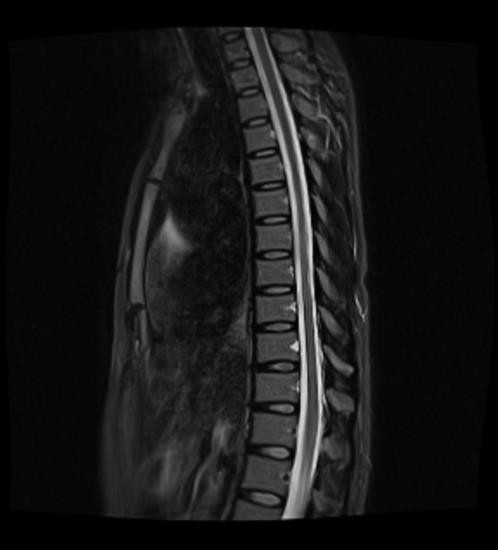 Superconducting MRI System