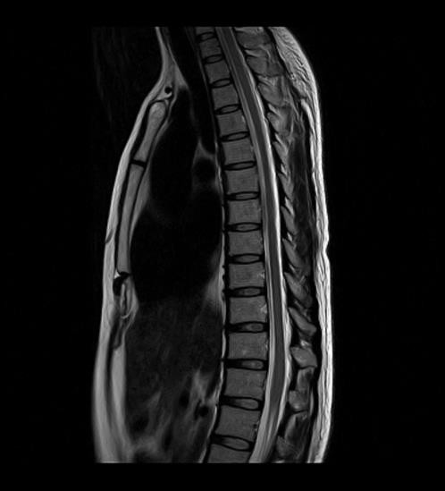 Superconducting MRI System